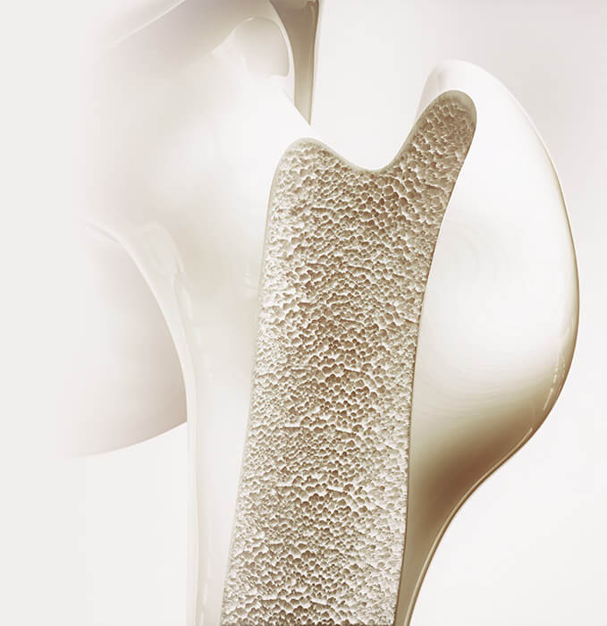 The Incredible Shrinking Woman - Ultimate Bone Support